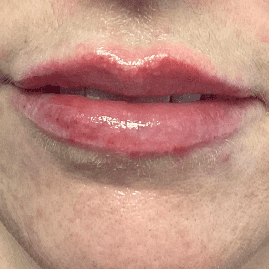 Our Technology | Dublin Based Laser Clinic | Laser + Skin Clinics